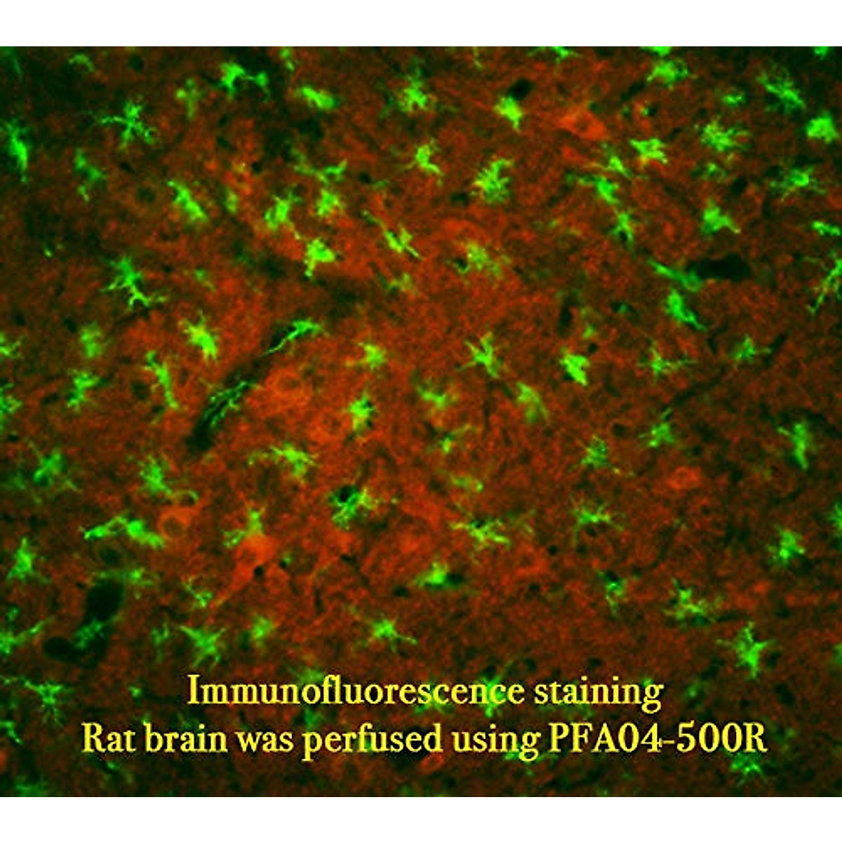 Paraformaldehyde, 4% in PBS - 500 mL - PFA04-500R