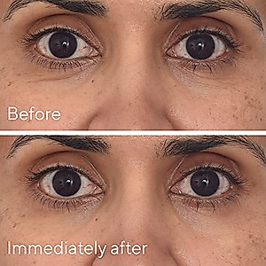 Murad Dr. Zion Retinol Youth Renewal Eye Masks – No-Slip Under Eye Patches for Fine Lines, Wrinkles, Crow’s Feet and Puffy Eyes - Full Absorption Treatment Strips, 5 Pairs