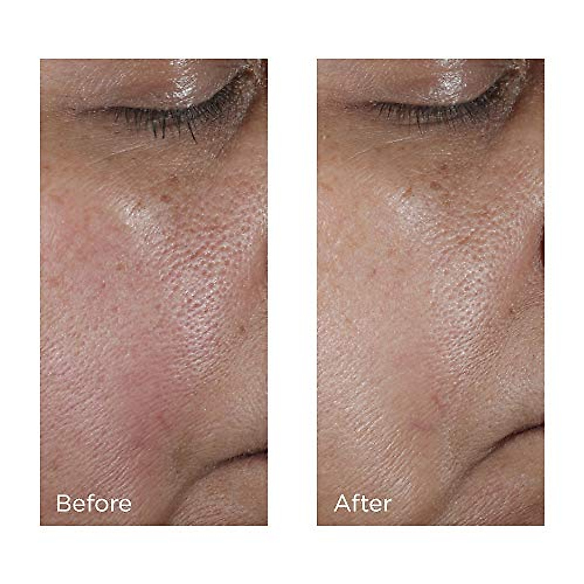 Perricone MD No: Rinse Intensive Pore Minimizing Toner 4 Ounce