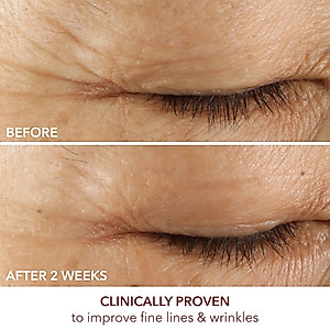 Dr. Dennis Gross Advanced Retinol + Ferulic Triple Correction Eye Serum | Firm Skin, Boost Hydration, and Reduce the Look of Wrinkles & Crepiness | 0.5 oz