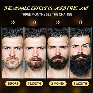 Beard Growth Oil With Biotin Caffeine Beard Oil For Men With Beard Brush Beard Growth Serum Stimulate Beard Growth Promote hair Regrowth Best GiftS for Father Day Dad Men Husband Boyfriend