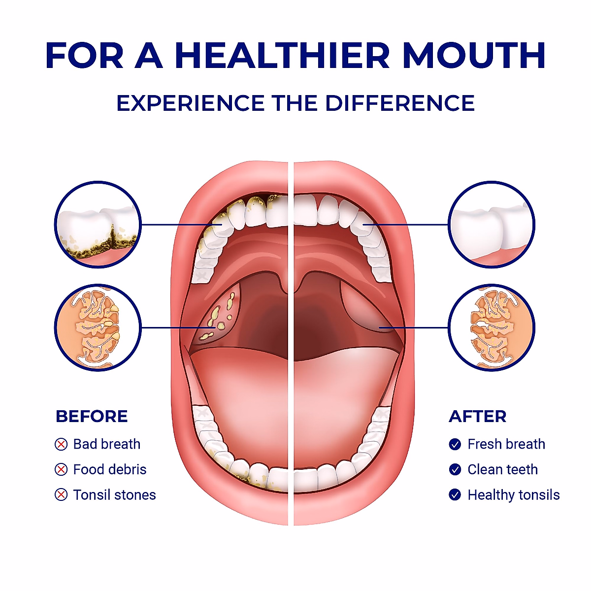 ORAVIX Dental Water Flosser, Tonsil Stone Remover, Gentle Oral Irrigator for Sensitive Teeth and Gums, Kids Manual Water Flosser, No Electricity or Batteries