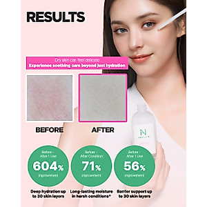 AMPLE:N Ceramide Shot Serum – Anti Aging and Hydrating Serum with Ceramide for Deep Moisturization – For Dry & Rough Skin to Reduces Wrinkles & Repairs Skin, 3.38 fl.oz.