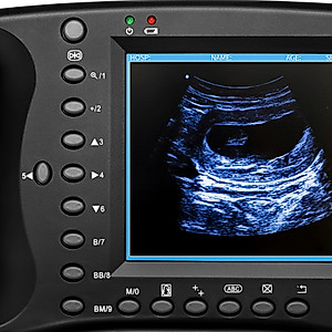 Portable Ultrasound Machine for Pregnancy - Digital Sonogram Machine with 3.5 MHz Probe and 8-Color Panels - Perfect for Sheep, Dogs, Cats, and Pigs Pregnancy Testing