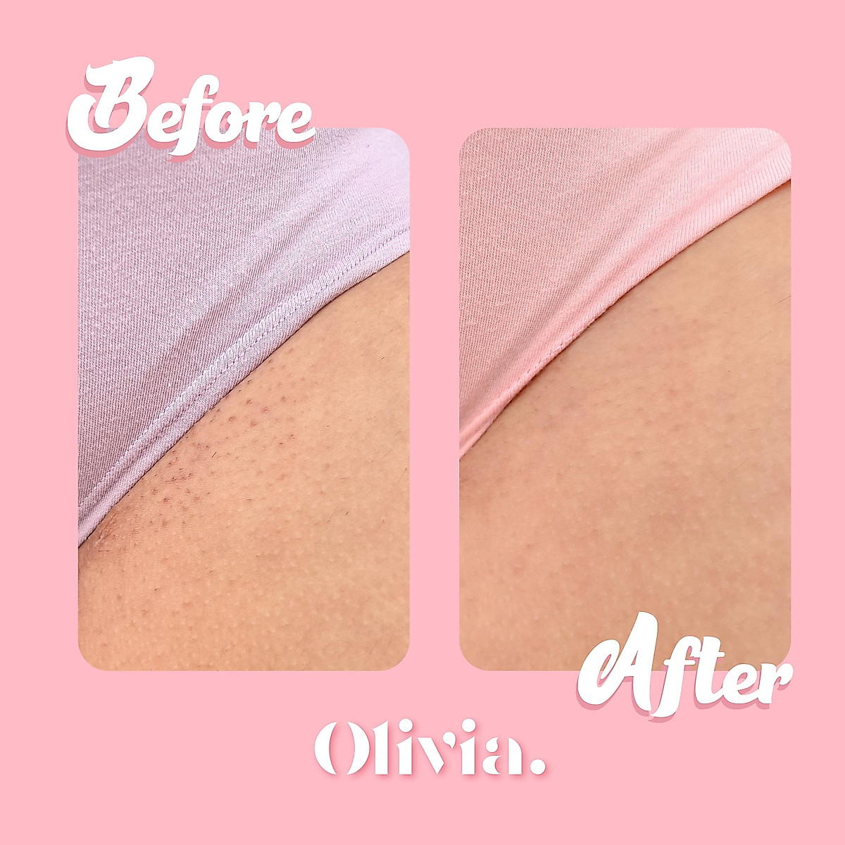 Olivia Beauty Bikini Exfoliating Scrub - All Natural Exfoliating Body Scrub for Women, Moisturizing Formula to Smooth, Exfoliate, and Restore Dry, Sensitive Skin, Provides Lasting Care, 8 Oz