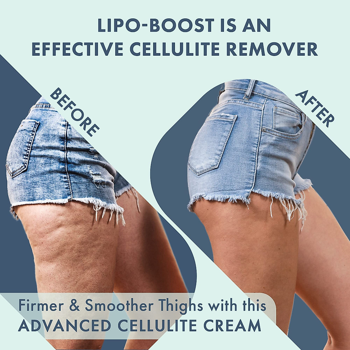 WeightLoss-Solutions Lipo-Boost Cellulite Cream with Caffeine is an Advanced Firming Lotion for Thighs and Butt, Stomach, Belly, Breasts, and Arms, to Smooth, Firm, Tone, and Tighten