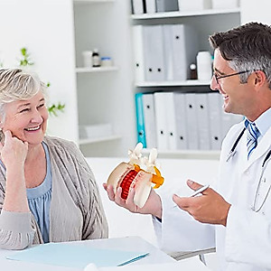 SKUMOD Human Lumbar Disc Herniation Model, Transparent Lumbar Spine Model, Lumbar Disc Anatomical Model with Elastic Software