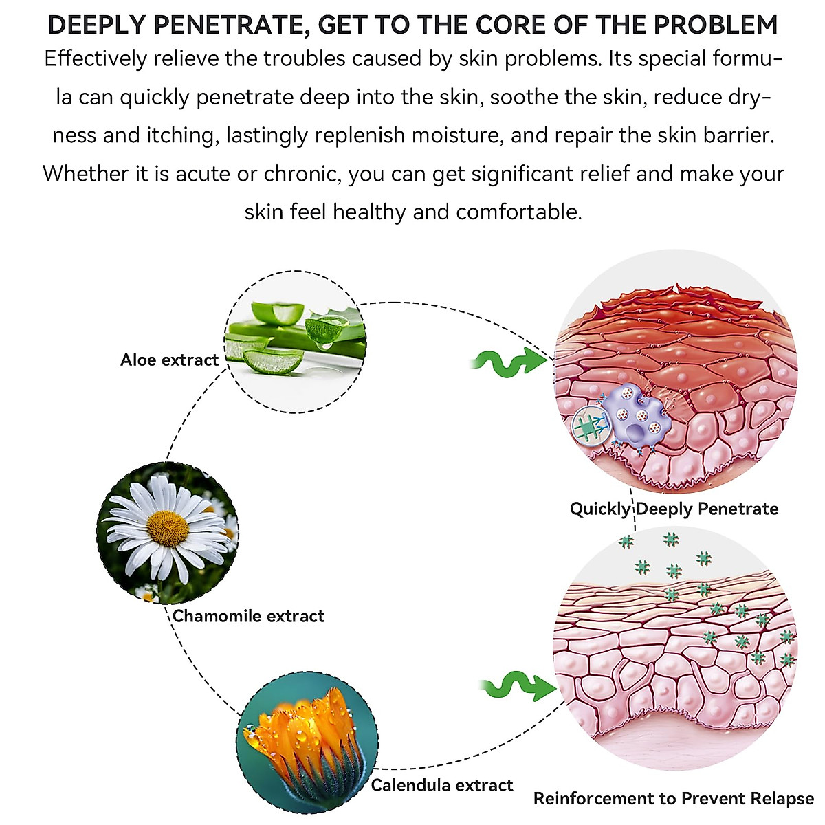 Heat Rash Itch Relief, Extra Strength Cream, Jock Itch, Athlete's Foot Hand Skin, Tinea Versicolor, Armpit, Itchy Feet, Psoriasis, Scalp Dandruff, Fast Relief for Eczema, Rosacea, 24h Soothing Treat