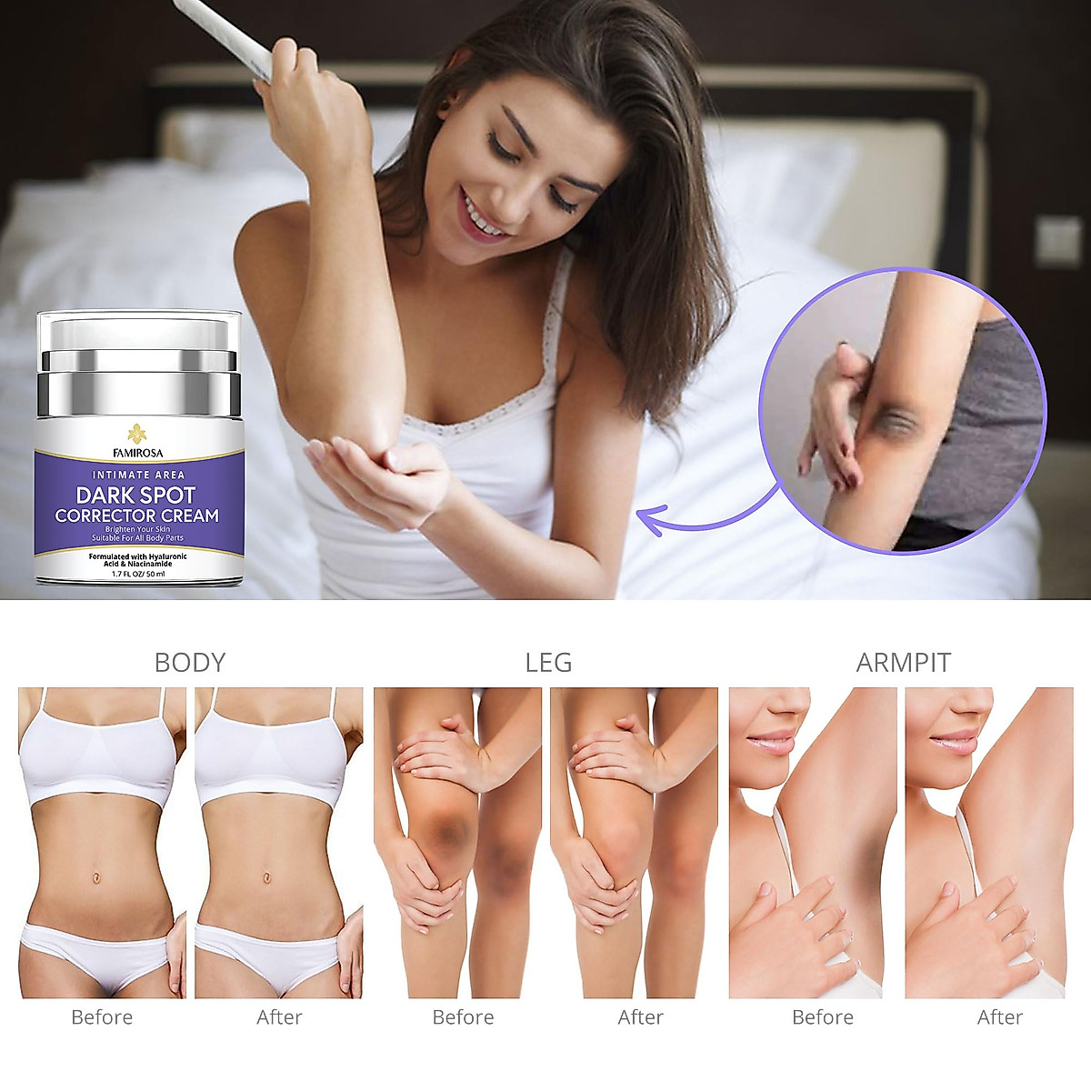 Famirosa Dark Spot Corrector Cream-Underarm Cream for Armpit, Neck, Knees, Elbows, Inner Thigh, Private Parts- Intimate Skin Cream- Formulated with Hyaluronic Acid, Niacinamide and Vitamin C-50 ml
