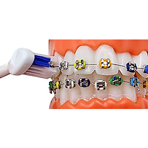 LBailar Braces Toothbrush| Soft Bristle Orthodontic Toothbrush for Cleaning Ortho Braces | U Shaped Portable Toothbrushes for Braces| Set of 4