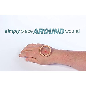 Jokari Healing Spacers 3 Pack for Small Scrapes, Scratches or Burns. Place Medical Grade Silicone Ring Around Affected Area, Wrap With Bandage, Secure With Tape to Allow for Airflow and Faster Healing