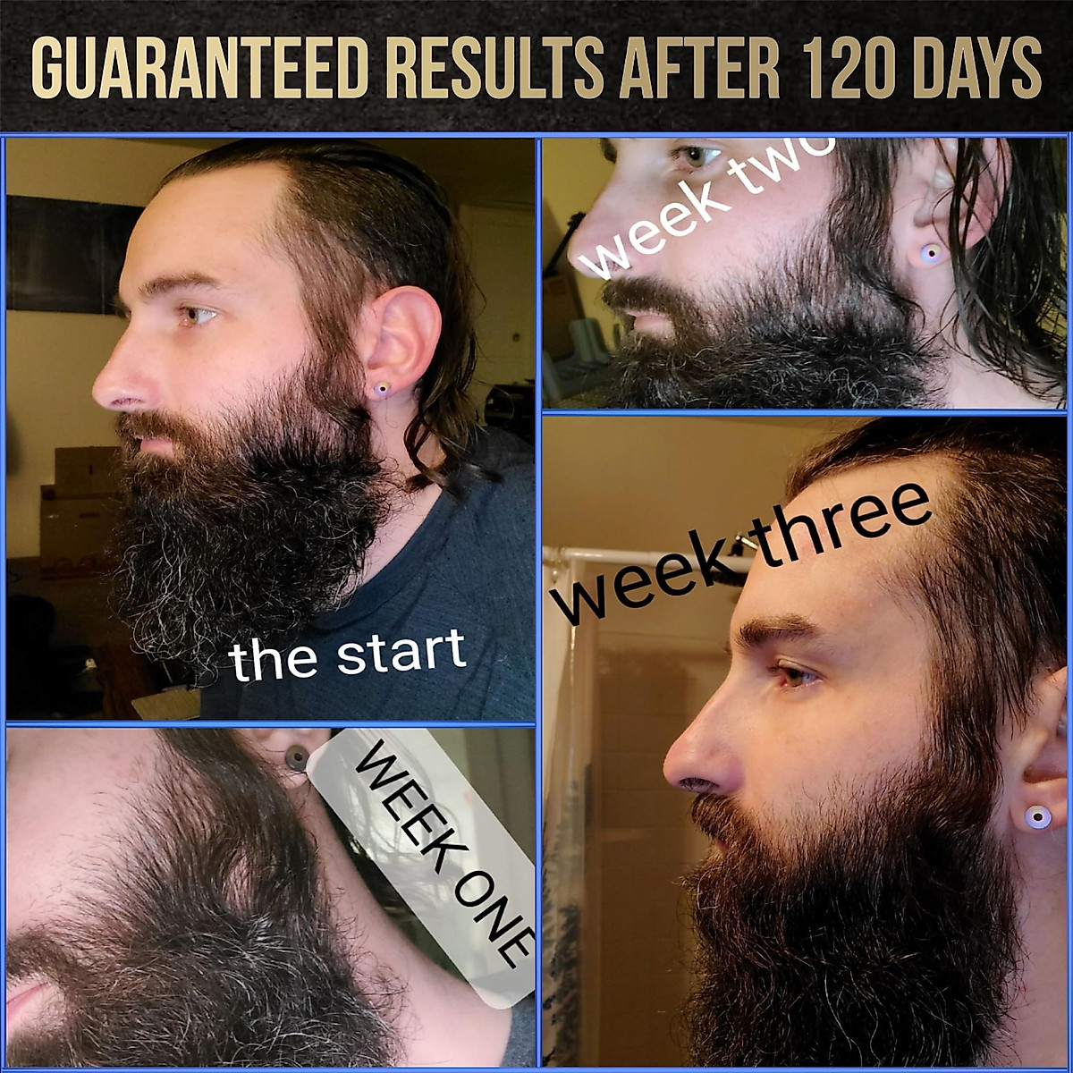 The Beard Struggle Voxtr Beard Growth Serum with Follicle Acceleration Matrix - Promotes Thicker & Healthier Beard - Beard Serum, 1.69 Fl. Oz. US