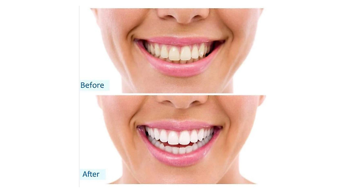 Pepsodent Complete Care Original Toothpaste - 24 Pack Bulk