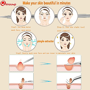 16 PCS Pimple Popper Tool Kit, Blackhead Remover Tools, Acne Extractor Tool, Cyst Removal Tool, Professional Stainless Steel Tweezers for Eyebrows Pimple Blemish Hair Removal, Tools for Beauty Salons