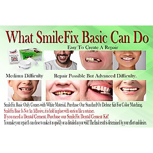 SmileFix Basic Dental Repair - for Missing Or Damaged Teeth - Fix Gaps, Missing Teeth, Spaces, Broken Tooth, Repairs - Fast & Easy - Confident Smiles - BF Products - Durable Compound