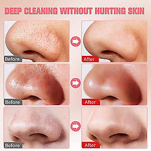 Blackhead Remover Pore Vacuum - LED Screen & USB Rechargeable Facial Pore Cleaner, Comedone Extractor Tool,Acne Extractor Tool with 3 Suction Power,4 Probes Black Head Remover for Face for Women & Men