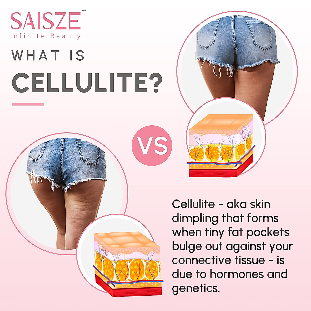 SAISZE Anti Cellulite Body Slimming Cream 8.8oz & Massager and Remover Brush Mitt (Slimming Cream + Massager)