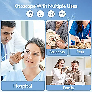 ScopeAround Digital Otoscope with Light, Ear Cleaning Camera and Wax Remover, Visual Ear Cleaner with 4.3" IPS Screen, 6 LED Lights, HD Video Ear Scope Camera, Supports Photo Snap and Video Recording
