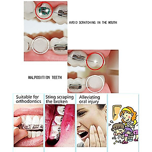 Chargenyang Dental Oral Care Orthodontics Wax with Fruit Smell for Brace Wearers Flavored Gum Protection (6 Boxes)