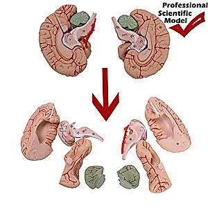 Altratech Human Skull Model Life-Size with Brain Removable Skullcap Professional Grade Anatomical Skull Model for Science Education, with Base (Life-Size with Base)