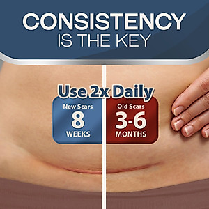 Ebanel Advanced Silicone Scar Gel with Allantoin, Emu Oil, Vitamin E and Onion Extract, Medical-Grade Cream for Old & New Scars from Surgeries, C-Section, Injuries, Burns, Keloids & More