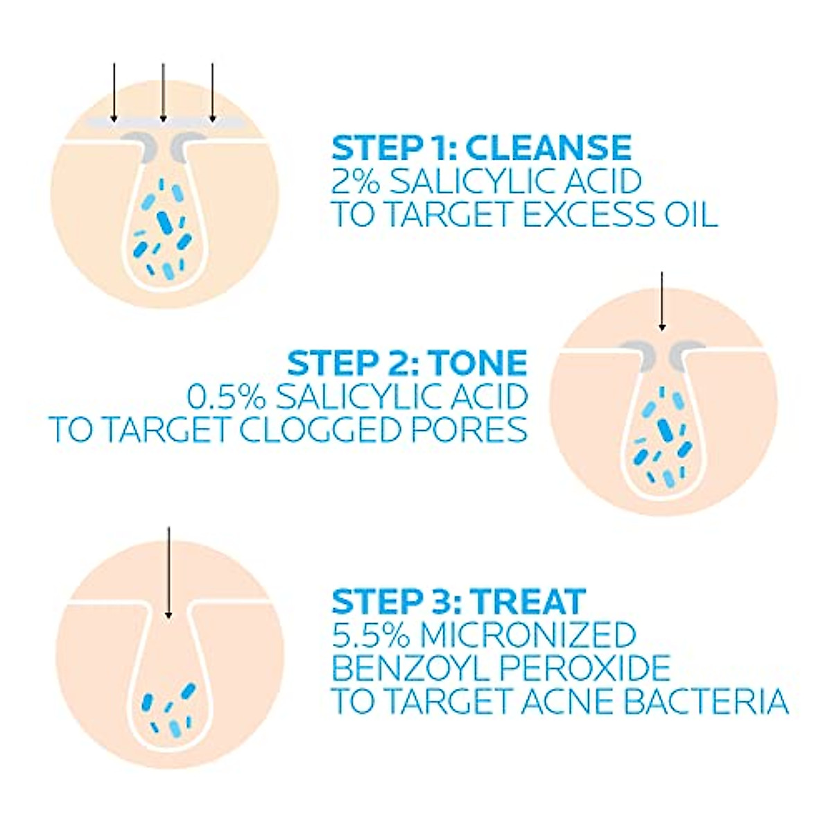 La Roche-Posay Effaclar Dermatological 3 Step Acne Treatment System, Salicylic Acid Acne Cleanser, Pore Refining Toner, and Benzoyl Peroxide Acne Spot Treatment for Sensitive Skin, 2-Month Supply