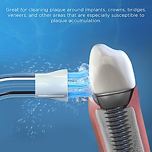 Replacement Tips for Waterpik Water Flosser (2 Classic Jet Tips + 2 Orthodontic Tips + 2 Plaque Chaser Tips+ Storage Case Combo)