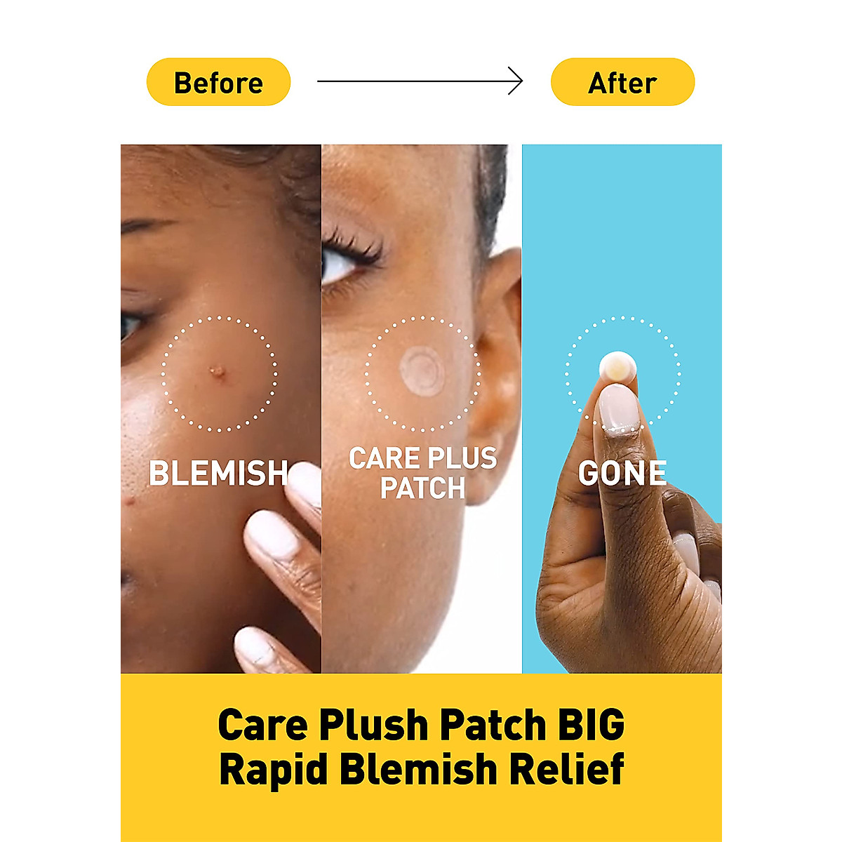 OLIVE YOUNG Care Plus Honey Scar Cover Korean Spot Pimple Patches 1Pack(84 Count) - Hydrocolloid Patch, Spot Stickers for Acne Pimple Blemishes and Zits, Contains Manuka Honey(10mm*60ea + 12mm*24ea)