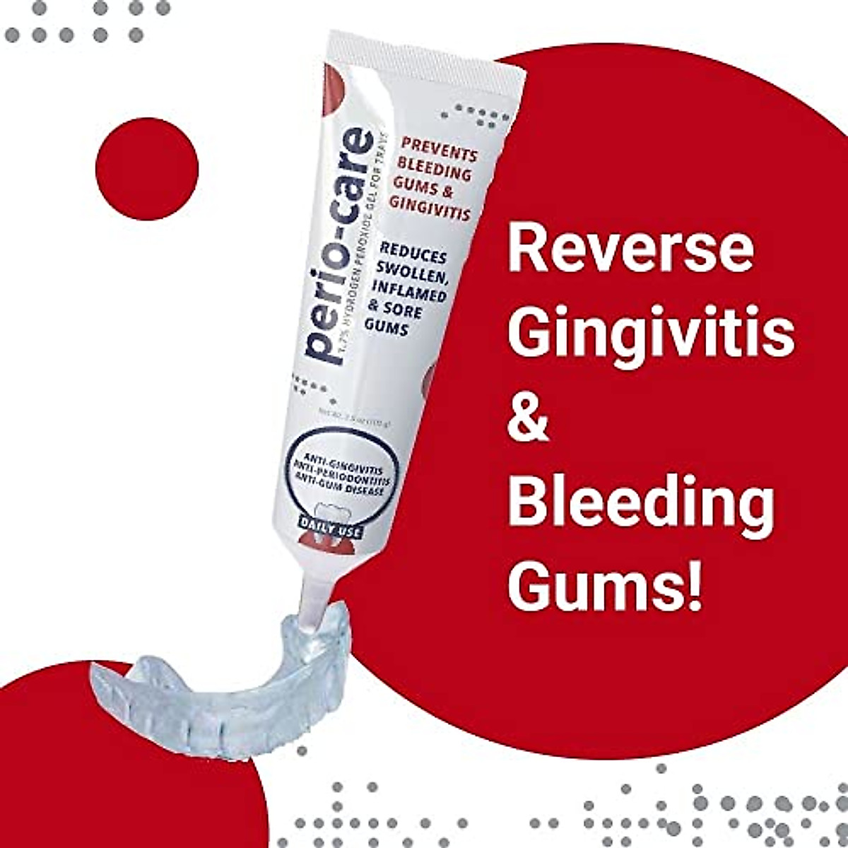 Perio-Care Gel for Trays (5 Tubes + Trays) - 1.7% Hydrogen Peroxide Gel - Designed to Treat Bleeding Gums, Gingivitis, Periodontitis, Periodontal Disease and Gum Disease