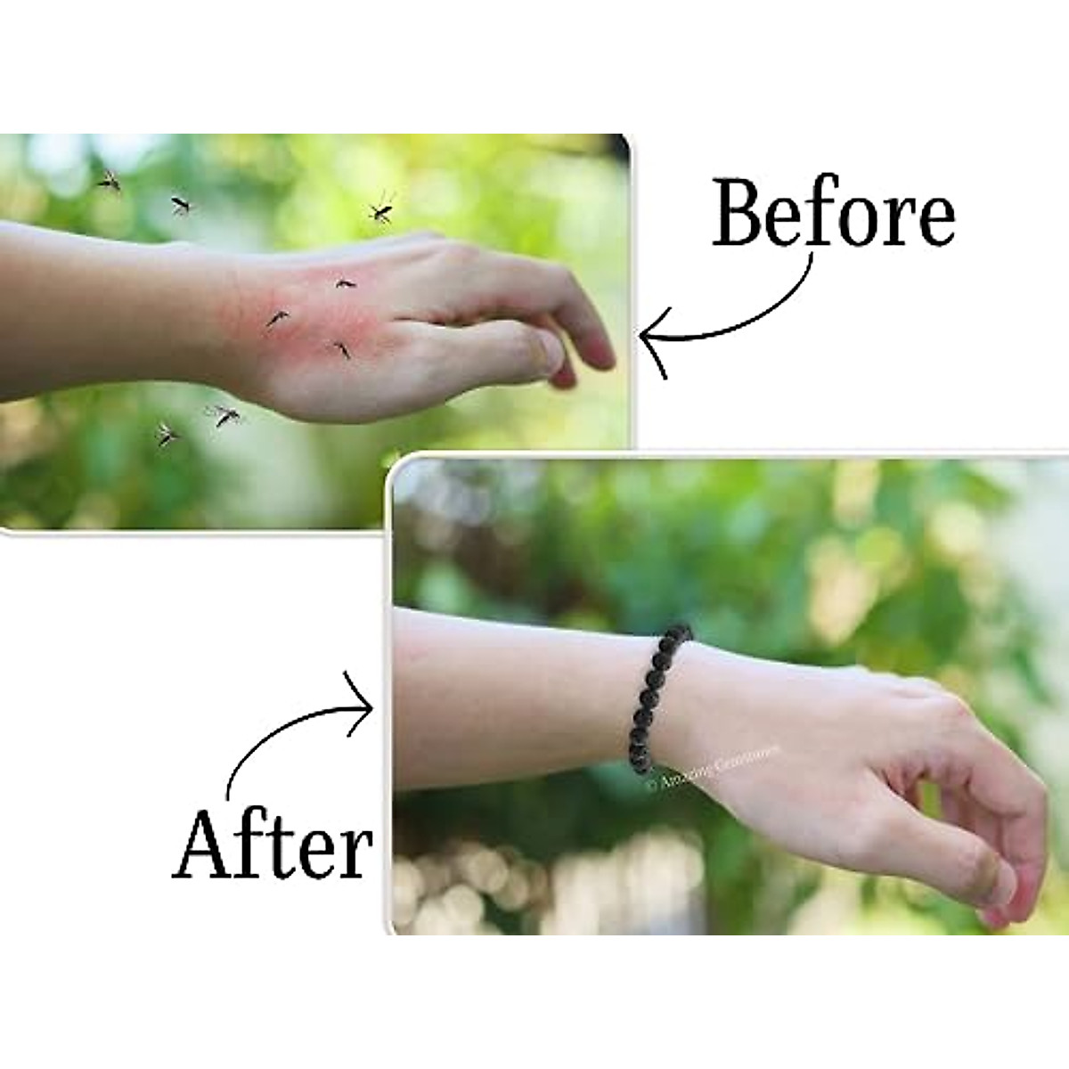 Mosquito Repellent Bracelets and Anklet Repeller with Essential Oil Refill Container - Lava Stone Camping Essentials Mosquito Bracelets for Adults Bug Repellent Bracelets - Pack of 2 Bug Bands