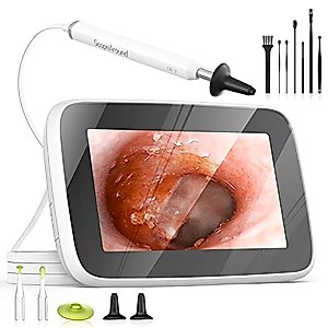 ScopeAround Digital Otoscope with Light, Ear Cleaning Camera and Wax Remover, Visual Ear Cleaner with 4.3" IPS Screen, 6 LED Lights, HD Video Ear Scope Camera, Supports Photo Snap and Video Recording