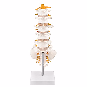 Ultrassist Human Spine Model with 5 Lumbar Vertebrae, Herniation Discs, Lumbar Nerves and Spinal Cord for Medical Teaching