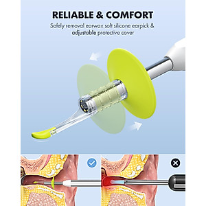 Anykit Digital Otoscope with Gyroscope, HD Ultra Clear View Ear Camera with Ear Wax Removal Tools, Video Ear Scope Otoscope with Light, Compatible with Android, iPhone 15 (Silver)