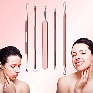 MelodySusie Blackhead Remover Pimple Popper Tool Kit - Professional Extractor for Nose and Face, Stainless Comedone, Blemish Whitehead Popping with Portable Metal Case.