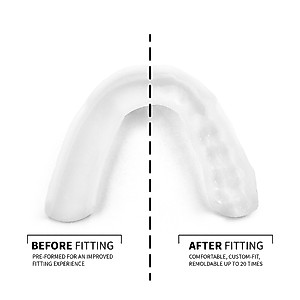 SOVA 3D Night Guard - 2.0mm Thin - Custom-Molded Fit - Protects Against Nighttime Teeth Grinding & Clenching - FSA/HSA Eligible - Odor & Taste Free - Remoldable Up to 20 Times - Non Toxic