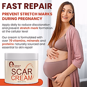 e70 Intensive Healing Scar Cream - Fast Repair Surgical Scars, C-Section, Stretch Marks, Keloids, Burns, Old & New Scars. Vitamins Full - All Skin Types - Reduce Acne Spots Appearance - 2.0 Fl Oz