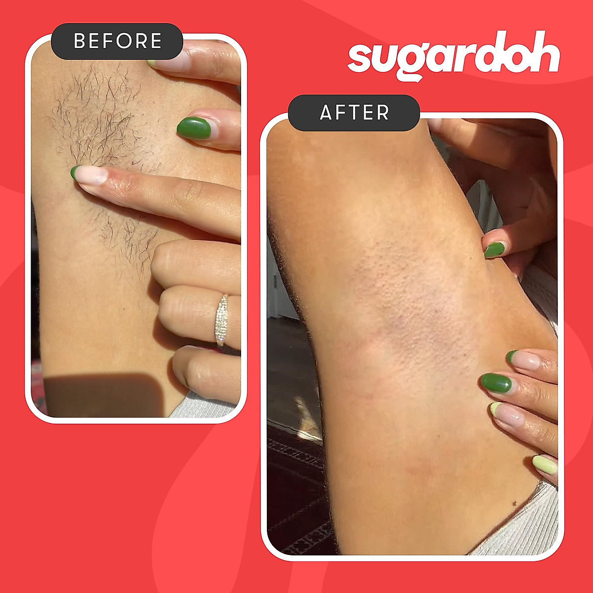 Sugardoh Sugar Waxing Kit for Women As Seen On Shark Tank (Vintage Kit Medium) - Face, Arms, & Legs - Sugar Wax Hair Removal - Sugaring Tiktok Products - Bikini Wax Kit for Women - Sugaring Kit