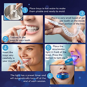 MagicBrite Complete Teeth Whitening Kit at Home Whitener - LED Light, 35% Carbamide Peroxide, 2 Mouth Trays, (3) 3ml Gel Syringes, Painless Effective