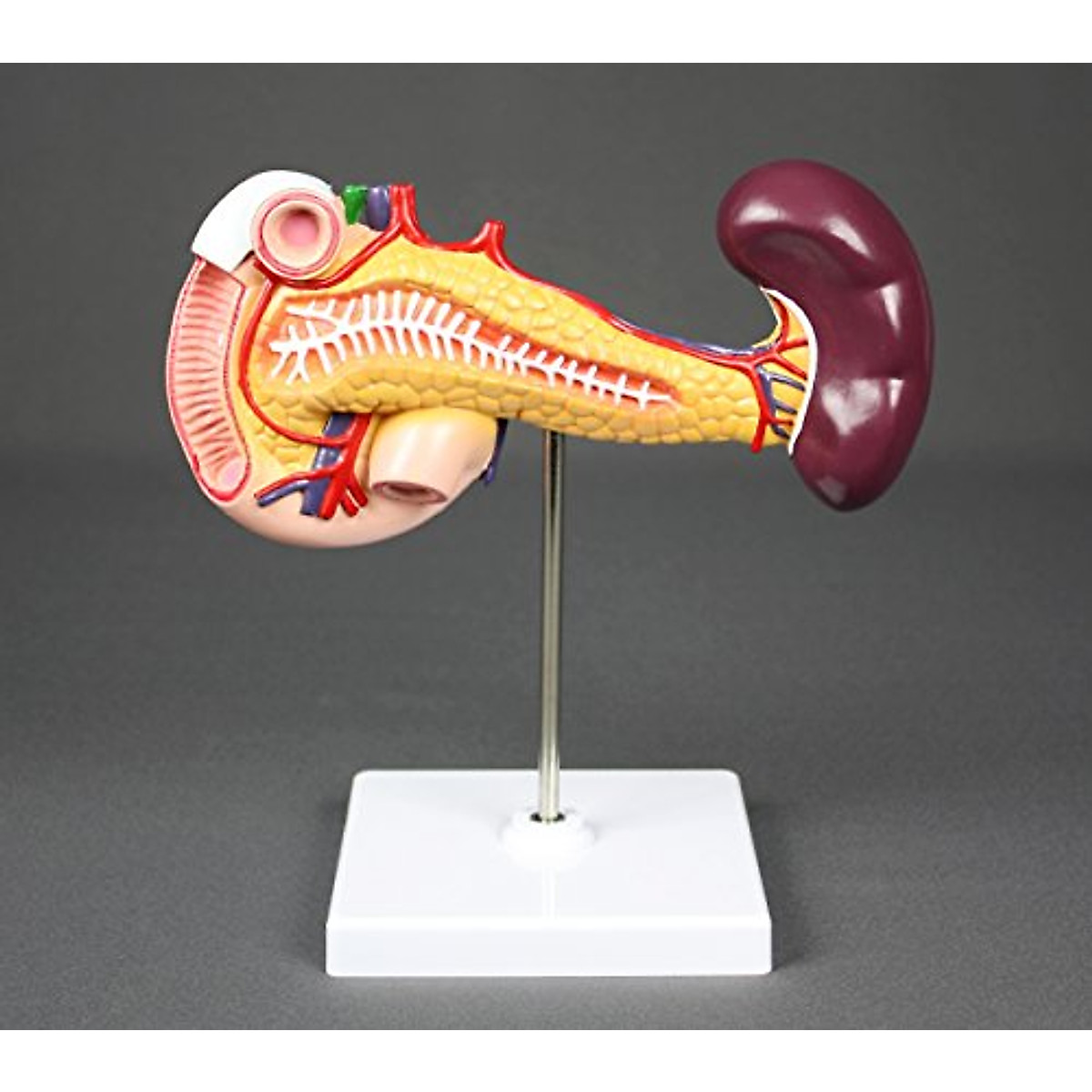 Vision Scientific VAD423-N Pancreas, Duodenum, & Spleen Model