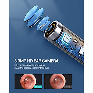 eutto Wireless Otoscope with Gyroscope, 0.15in Probe HD Ear Camera, 6 LED Lights, Ear Inspection Camera, Ear Wax Removal Tools, Compatible with iPhone and Android