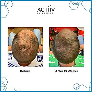 ACTIIV Recover Thickening Cleansing Hair Loss Shampoo Treatment for Men, 7 Fl oz (Packaging May Vary)