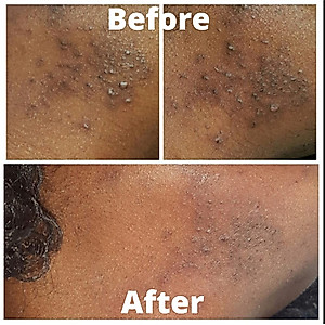 FAIR & WHITE Original Exfoliating Soap - 200g / 7oz – Skin Brightening Soap, Cleansing Bar, Formulated to Fade Dark Spots: Face, Knees, Body, Elbows & Armpits