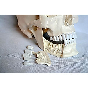 Wellden Medical Anatomical Skull Model, 4-Part, with Lower Jaw 16 Teeth Extractable