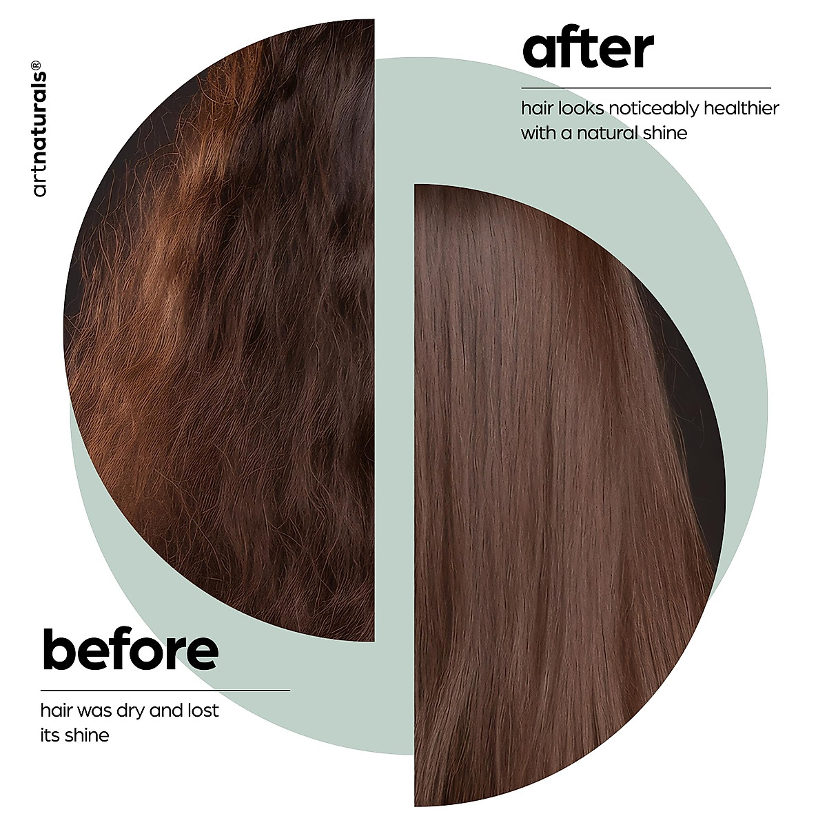 artnaturals Tea Tree Conditioner 16 Fl Oz - Sulfate Free – Made w/ 100% Pure Natural Therapeutic Grade Tea Tree Essential Oil - For Dandruff, Sensitive, Itchy, Dry scalp - For Men & Women