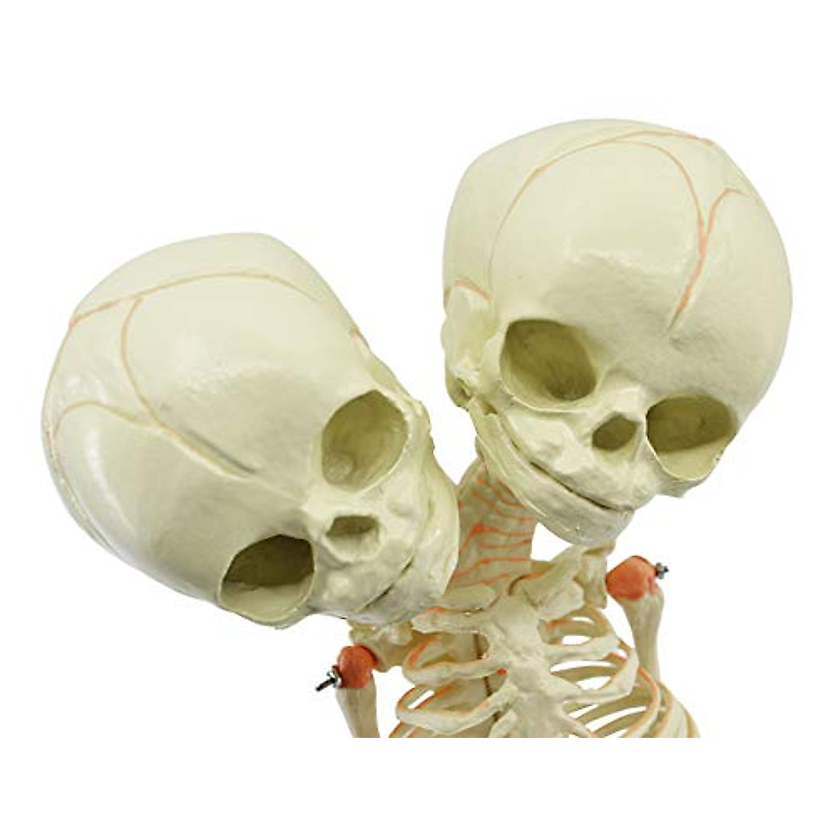 Infant Fetus Skeleton Model, Mini Size - Twin, Conjoined Skull - Rod Mounted - Incredible Detail for Anatomical Study - Eisco Labs