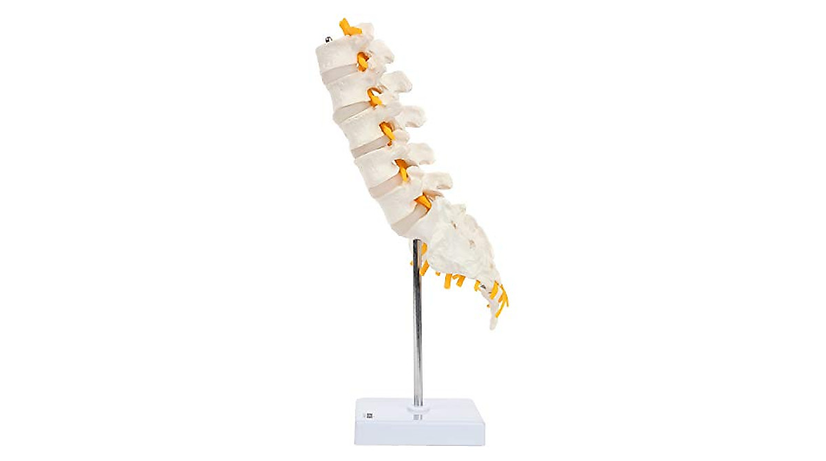 Lumbar Spine Anatomy Model with Nerves & Herniated Disc | Axis Scientific