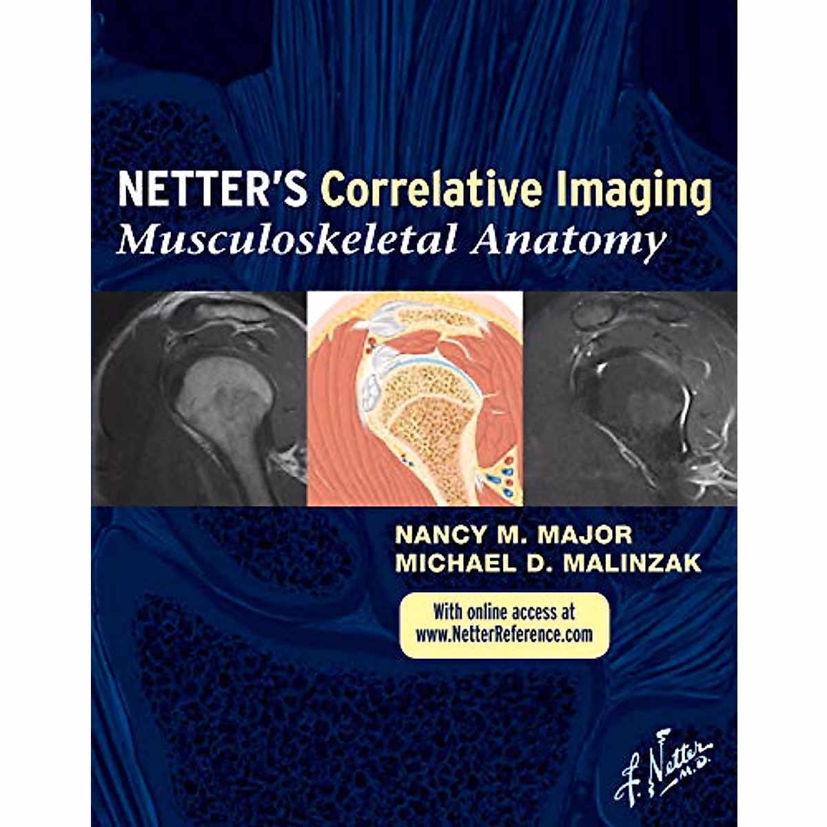 Netter's Correlative Imaging: Musculoskeletal Anatomy: with Online Access at www.NetterReference.com (Netter Clinical Science)