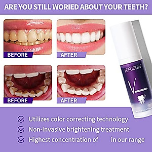 Whitening Toothpaste, Dental Colour Corrector, Purple Toothpaste for Teeth Whitening, Deeply Cleaning Gums, Stain Removal, Free of Peroxide, with Natural Formula, Not Causing Sensitivity 30ml