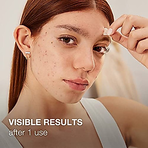 Neutrogena Stubborn Acne Pimple Patches, Acne Treatment for Face, Ultra-Thin Hydrocolloid Spot Stickers Provide Optimal Healing for Pimples, 24 Patches