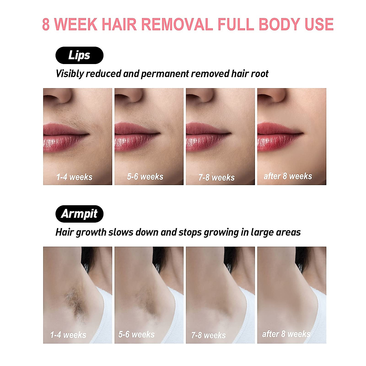 LANGQII IPL Hair Removal Device - Permanent Hair Removal for Women - Bikini Legs Armpit Facial Hair Removal 999,999 Flashes